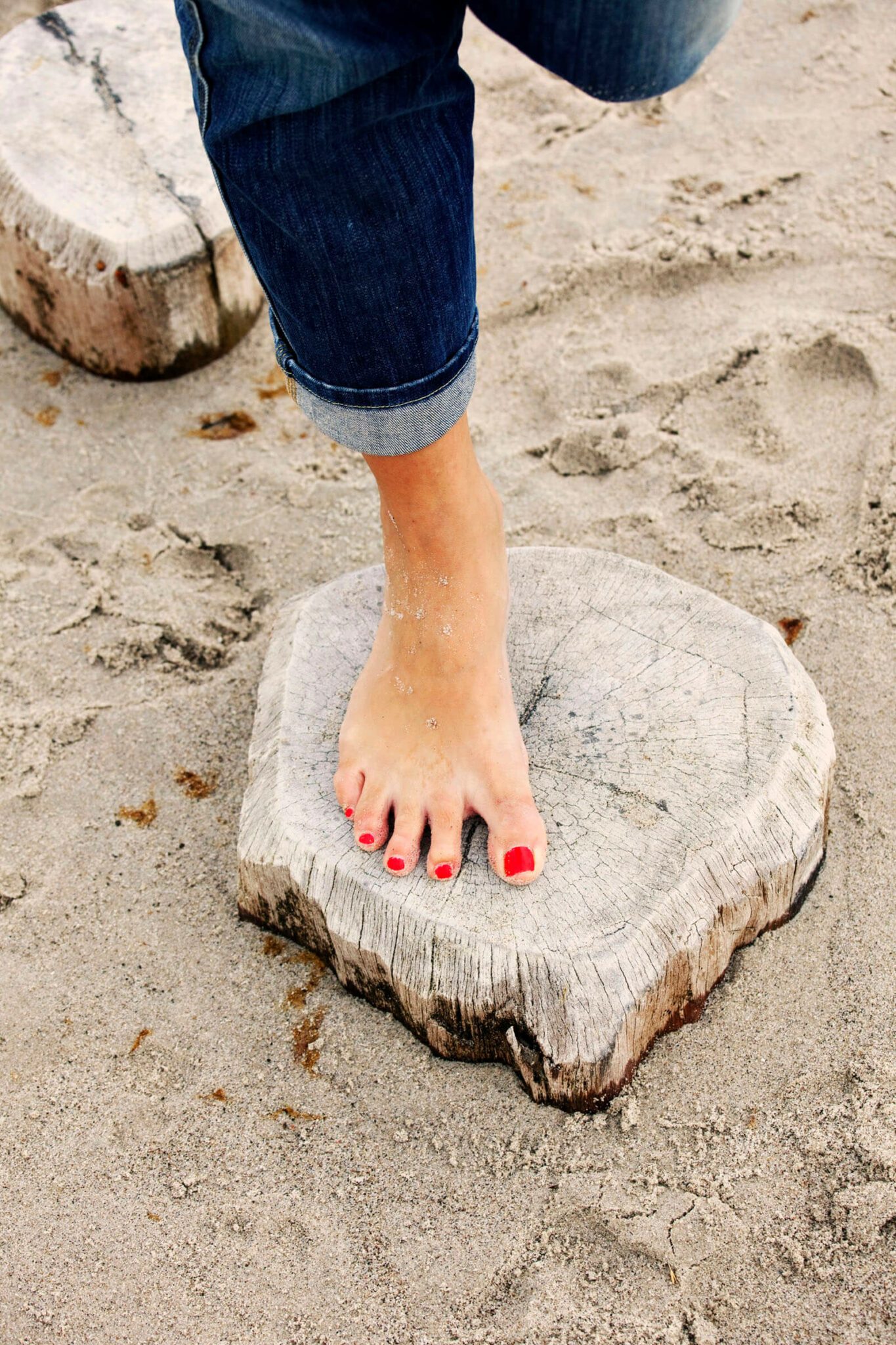 El mejor tratamiento para el pie de atleta - España